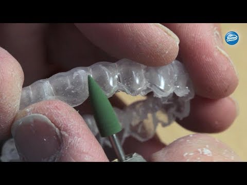 Vídeo | Modelado de los bordes de una ferula oclusal blanda – Komet Dental